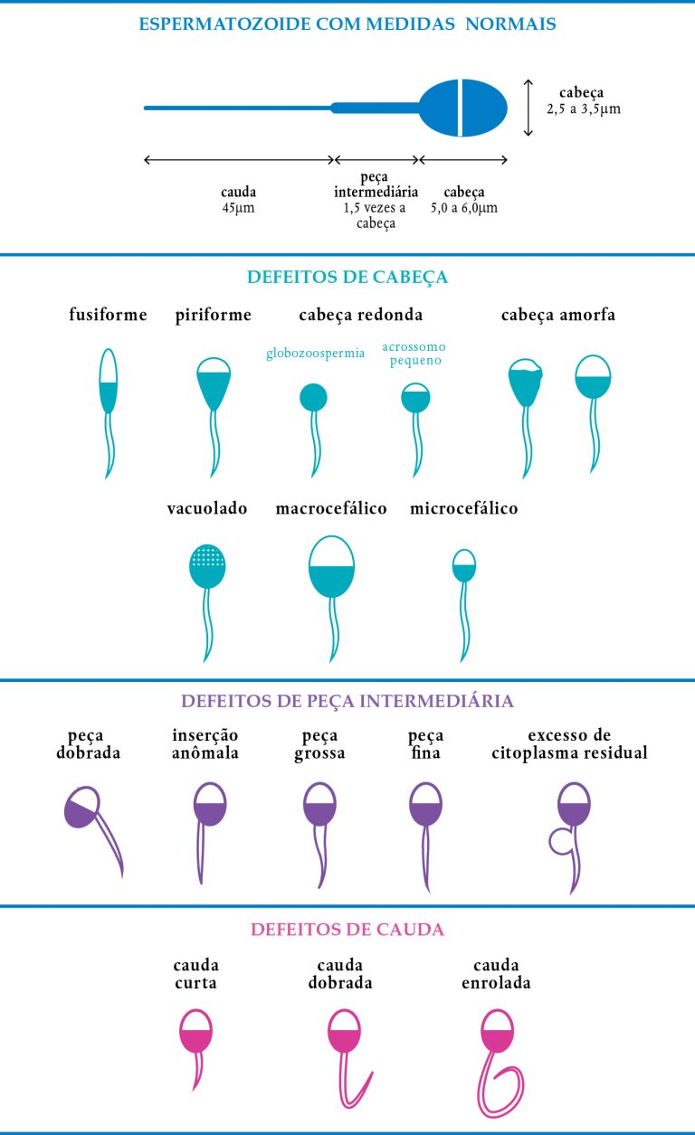 O Espermatozoide e o espermograma - IPGO - Centro de Medicina Reprodutiva