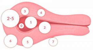 CLASSIFICAÇÃO ANATÔMICA - IPGO - Centro de Medicina Reprodutiva